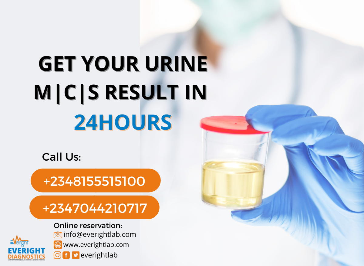Urine Culture MCS Everight Diagnostic Laboratory Services